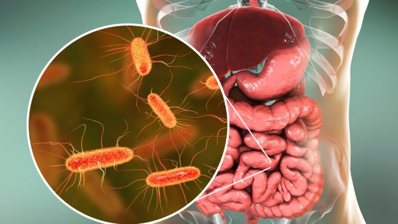 Gut Dysbiosis vs. SIBO: What’s the Difference and Why It Matters
